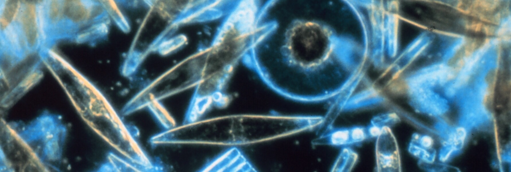 Marine Plankton Tell the Long Story of Ocean Health & Maybe Human Too ...